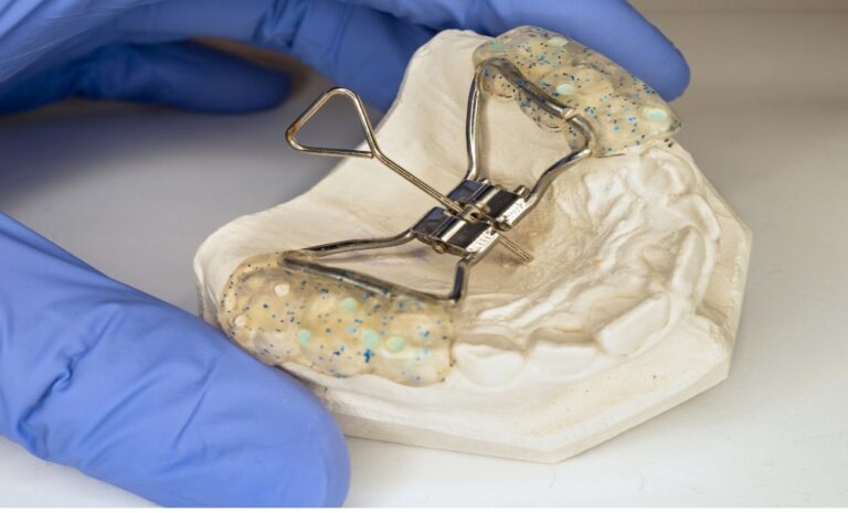 Types of Orthodontic Appliances in Charlotte NC